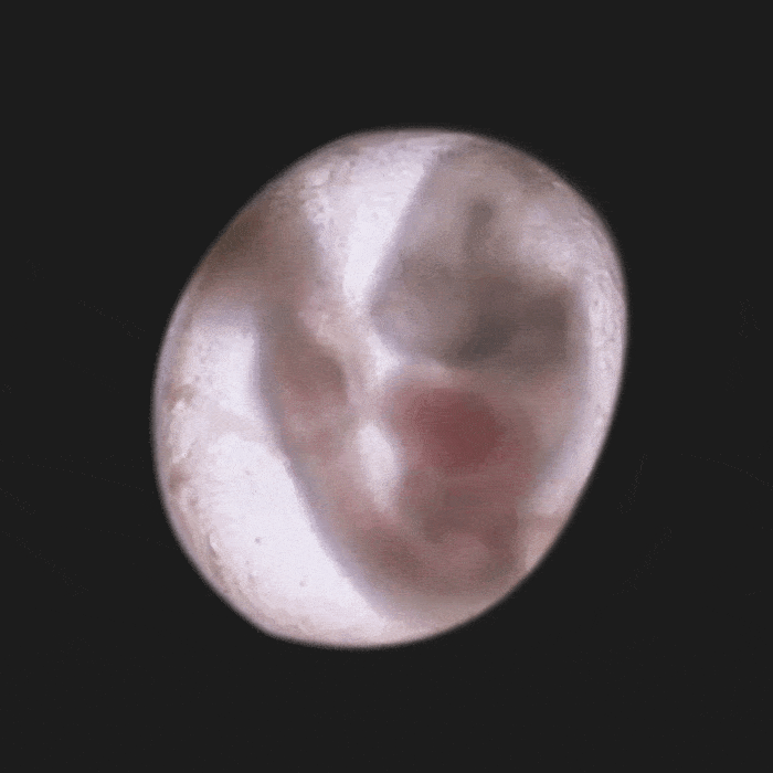 This Is Not Science Fiction. Israeli Researchers Have Grown an Embryo ...