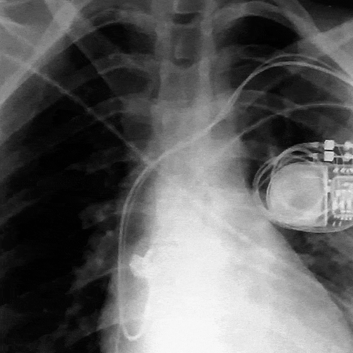 A Corporation Saved My Life. Now It Watches My Every Move - Israel News ...